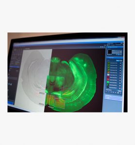 Microx » Software ZEN